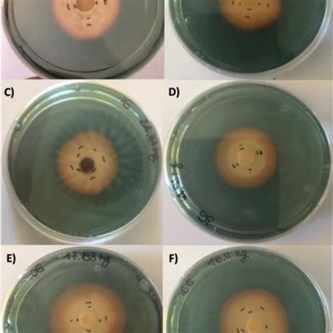 Inhibition Percentage Of Siderophore Production Biological Activity Download Scientific