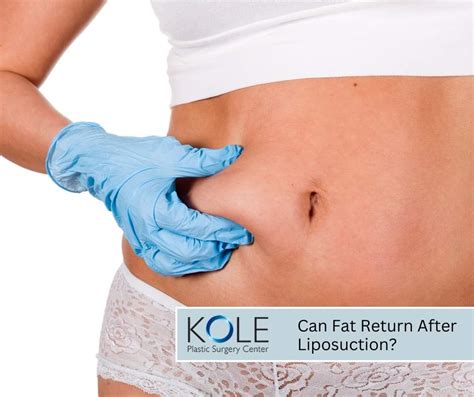 Can Fat Return After Liposuction Kole Plastic Surgery