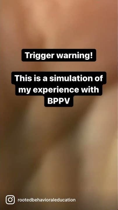 What Does Benign Paroxysmal Positional Vertigo Bppv Look Like From