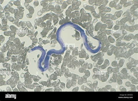 Loa Loa Parasite Hi Res Stock Photography And Images Alamy
