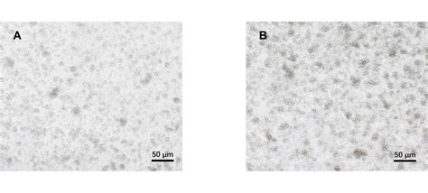 In Vitro Differentiation Of Naive Cd4 T Cells Into Pathogenic Th17 Cells In Mouse