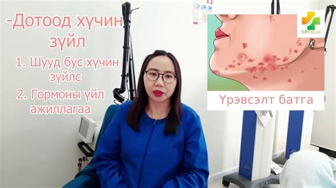 Топ Монголиа эмнэлэг Батга эмчилгээ ба зөвлөгөө Youtube