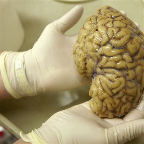 Kuru Brain