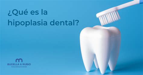Qué es la hipoplasia e hipomineralización dental Bugella Rubio