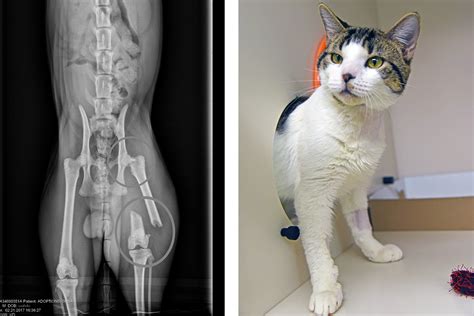 Broken Back X Ray