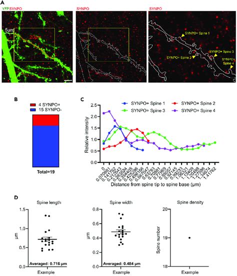Determination Of Dendritic Spine Features A Representative Results Download Scientific