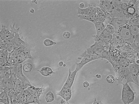 Are My 293t Cells Infected Researchgate