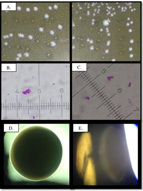 Phân Lập Vi Khuẩn Lactobacillus Spp Từ Cơm Mẻ