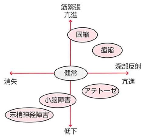 Images of 深部腱反射 JapaneseClass jp