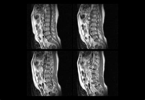 등 척추 Mri 및 Ct 스캔 전문 엑스레이 이미지 프리미엄 사진