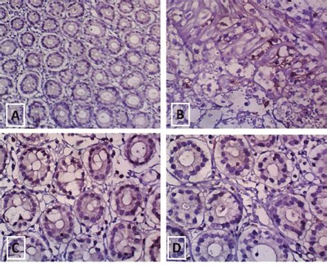 A Immunohistochemical Localization Of Inos In Normal Control B