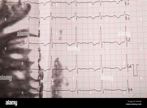 Eeg Stock Photos Eeg Stock Images Alamy