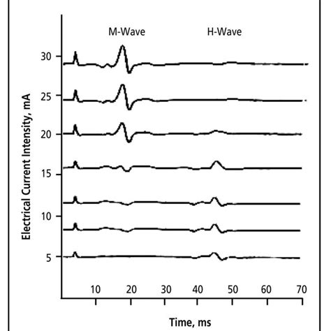 Sample Electromyogram Emg Responses Of A Subjects Soleus Muscle To