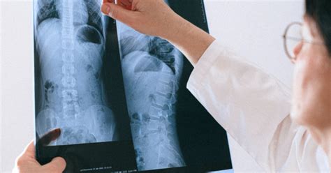Co warto wiedzieć o szkoleniach z diagnostyki obrazowej Aktualności VIKI MED