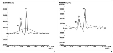 Adjustments To Spectra A Automated Baseline Correction Sinusoidal