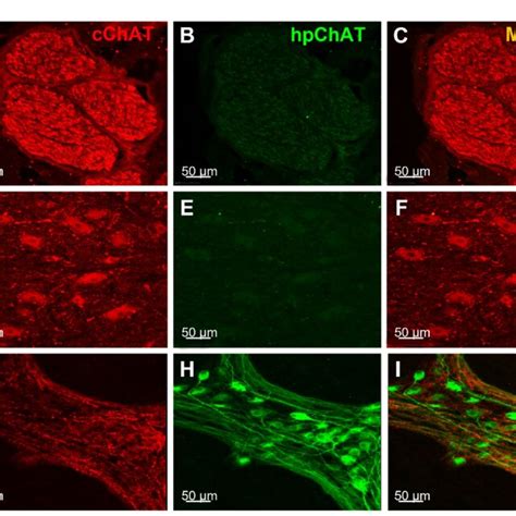 The Central And Peripheral Cholinergic Nerve Fibers And Neurons Were