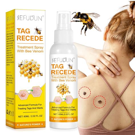 Tongzeng 3packs Personal Skin Carewart Spray Gram Warts Exfoliation