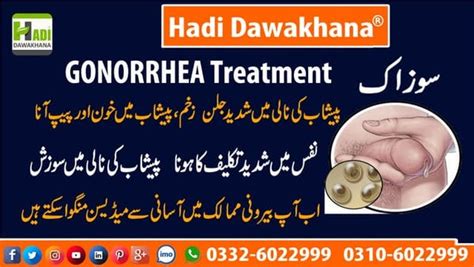 Vagina Tight Karny Ka Tarika Loose Vagina Ka Ilaj Hadi Dawakhana