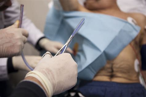 Chest Tube Insertion