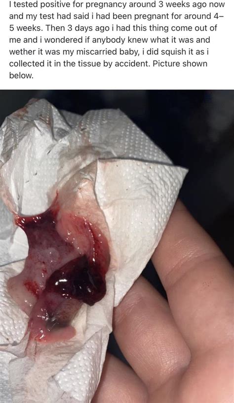 Please Help Rmiscarriagehelp