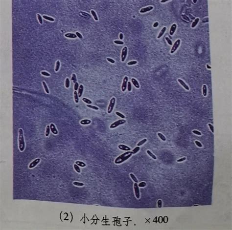 镰刀菌形态染色与培养特性