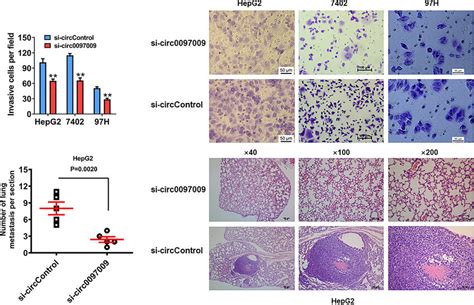Downregulation Of Circ0097009 Inhibits The Invasion And Metastasis Of