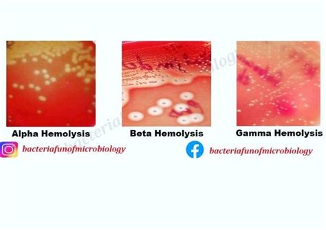 Narayan Ahirwar On Linkedin Alpha Hemolysis Streptococcus Beta Hemolysis Staphylococcus…