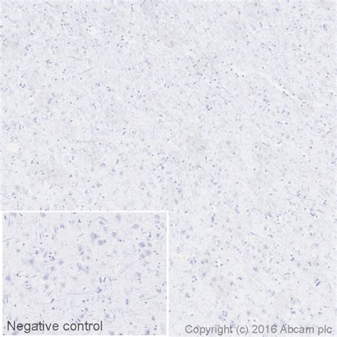 Lambda Light Chain重组抗体[epr5367 62] Lambda Light Chain抗体 Ab200966