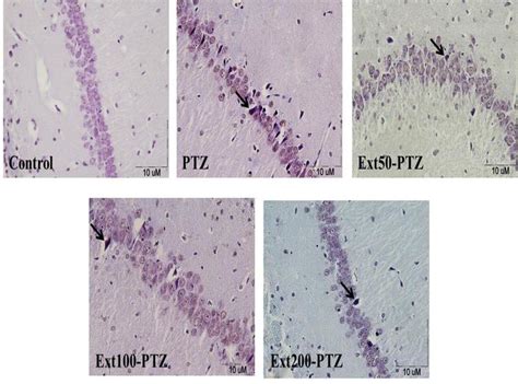 Light Microscopic Images Of Normal Pyramidal Cells And The TUNEL Download Scientific Diagram