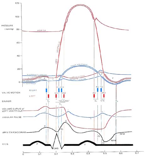 Hemodynamic Waveforms Flashcards Quizlet