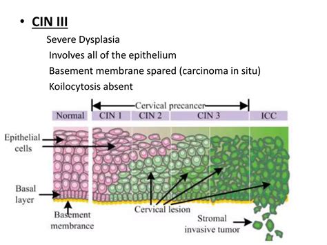 Cervical Neoplasms Pptx