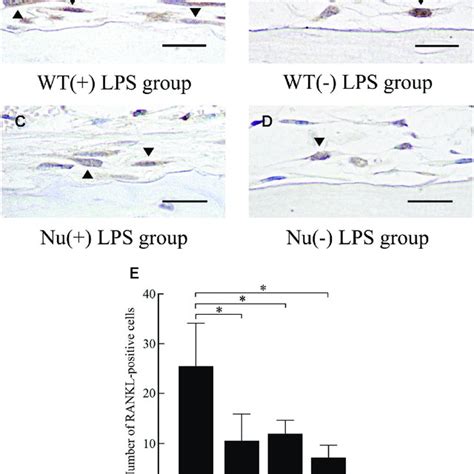 Immunohistological Findings Aed And The Number Of Rankl Positive