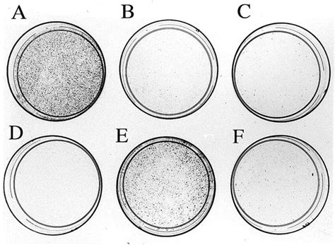 Colony Formation Assay In Saos 2 Cells Grown For 2 Wk Under G418