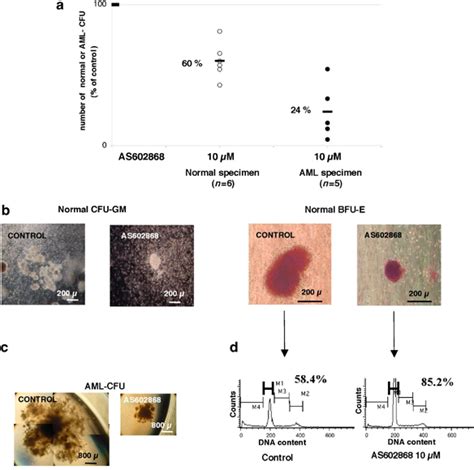 Clonogenic Potential Of Aml And Normal Cd34 After In Vitro Treatment