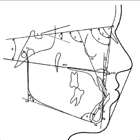 Angular Measurements 1 SNA 2 Maxillary Incisor SN 3 SNB 4