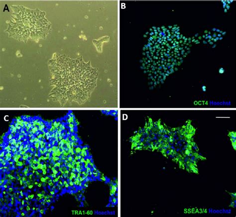 Phase Contrast Image Of Standard Hipsc Cultured On Vitronectin A And