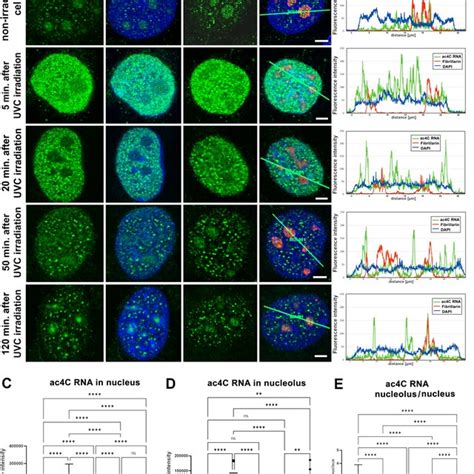 A High Density Of Ac C RNA Is Inside Nucleoli On Non Irradiated Cells