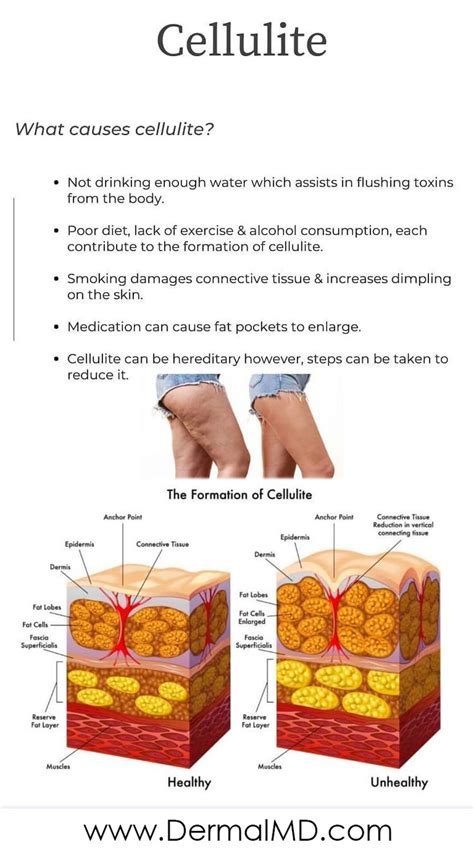 Cellulitis System Disorder Template