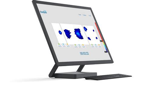 Xsensor Surgical Table Monitoring