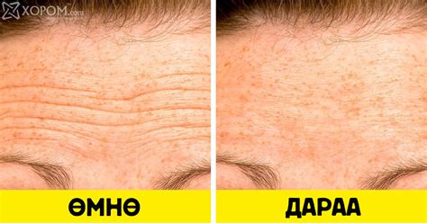 Духан дээрх үрчлээг гэрийн нөхцөлд бүдгэрүүлж арилгах байгалийн