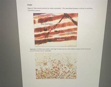Solved Exercise 1 Examine The Microscope Slides For Neuron