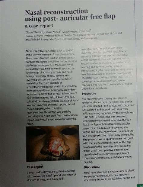 Pdf Nasal Recontruction Using Postauricular Flap