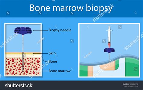 Stem Cell Collect ภาพประกอบและภาพวาดปลอดค่าลิขสิทธิ์และรับสิทธิ์ใช้งาน