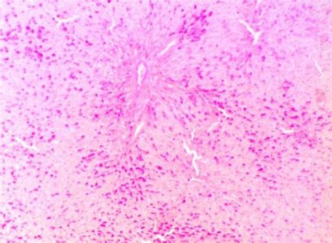 Photomicrograph Of A Section Of A Control Rat Liver Demonstrating