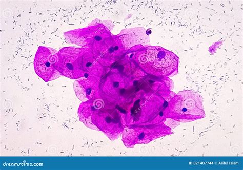 Cheek Epithelial Cells Bacteria Cheek Epithelial Cells Bacteria