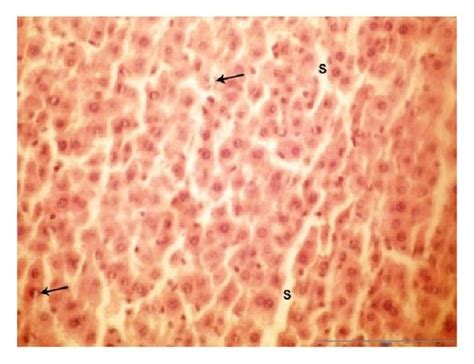 Light Microscope Examination Of Liver Tissues Photomicrograph Of Liver
