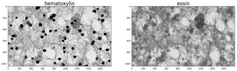 nuclei segmentation — histomicstk 0 1 0 documentation