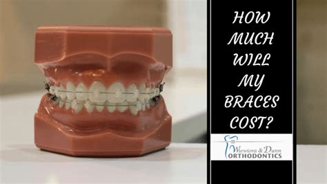 How Much Will My Braces Cost Wiewiora And Dunn Orthodontics