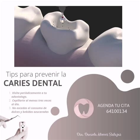 ¿qué Es Lo Que Causa Las Caries Las Caries Son Zonas Dañadas De Forma