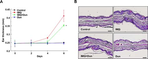 Dun Inhibits Imq Induced Psoriasis Like Inflammation Of The Ear Skin In
